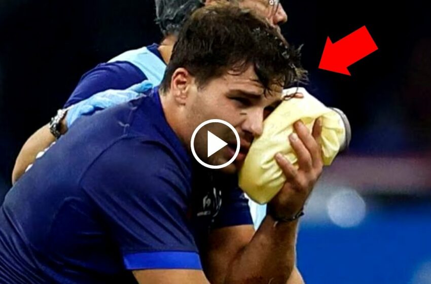 video blessure dupont